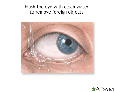 First Aid For Foreign Object In Eye